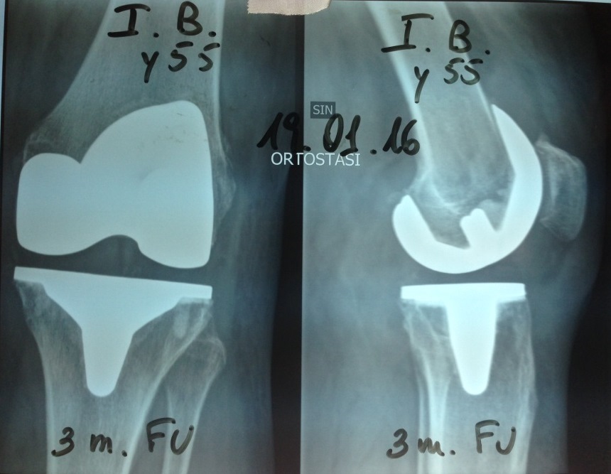 Dr. Marcello Genco - Ortopedico - San Marzano Sul Sarno (SA)